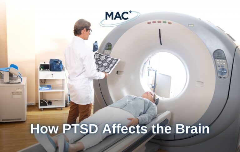 How PTSD Affects the Brain - MAC Clinical Research
